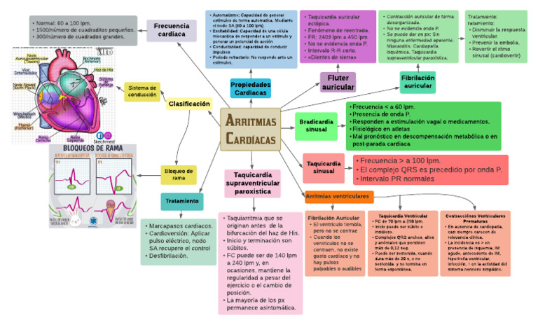 Mapa Arritmias Ventriculares | PDF | Sistema cardiovascular | Corazón