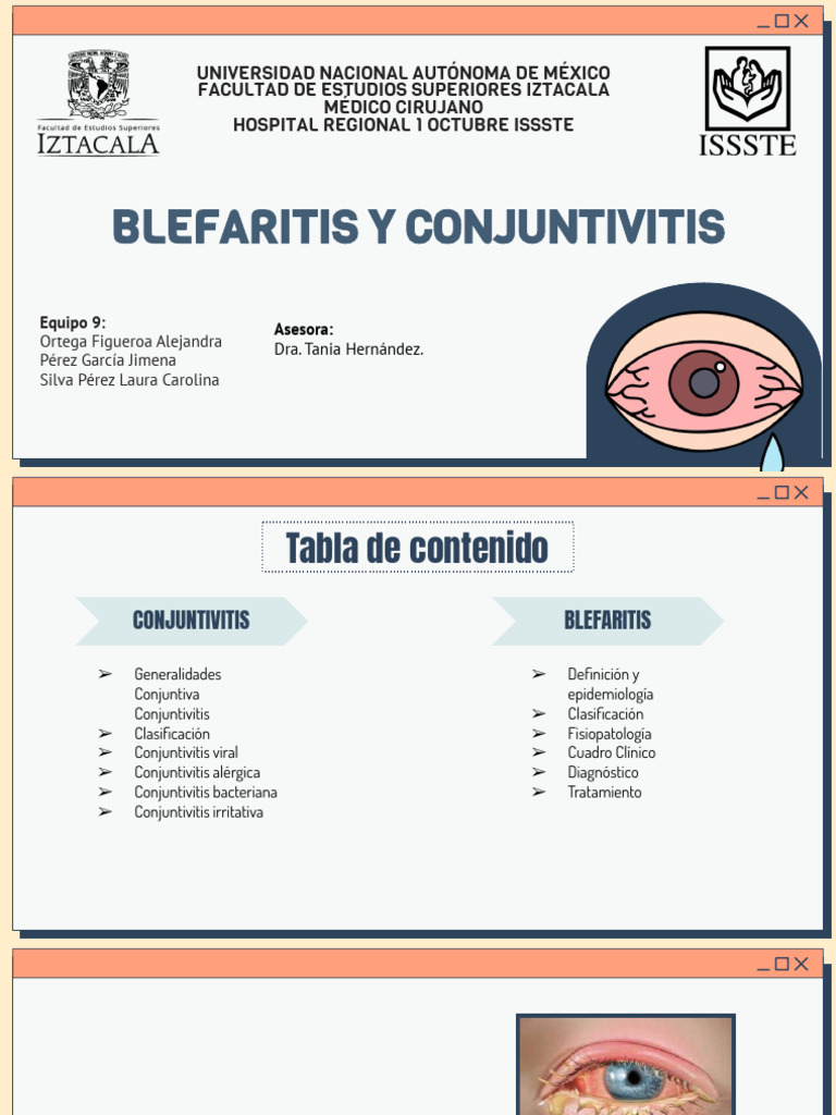 Blefaritis y Conjuntivitis. Equipo 9 | PDF | Epidemiología ...