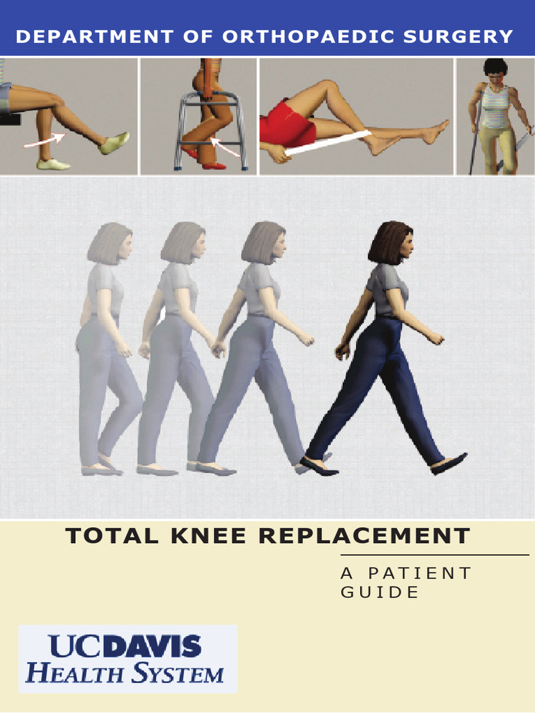 Knee Assessment For Total Knee Arthroplasty | PDF | Surgery | Anesthesia