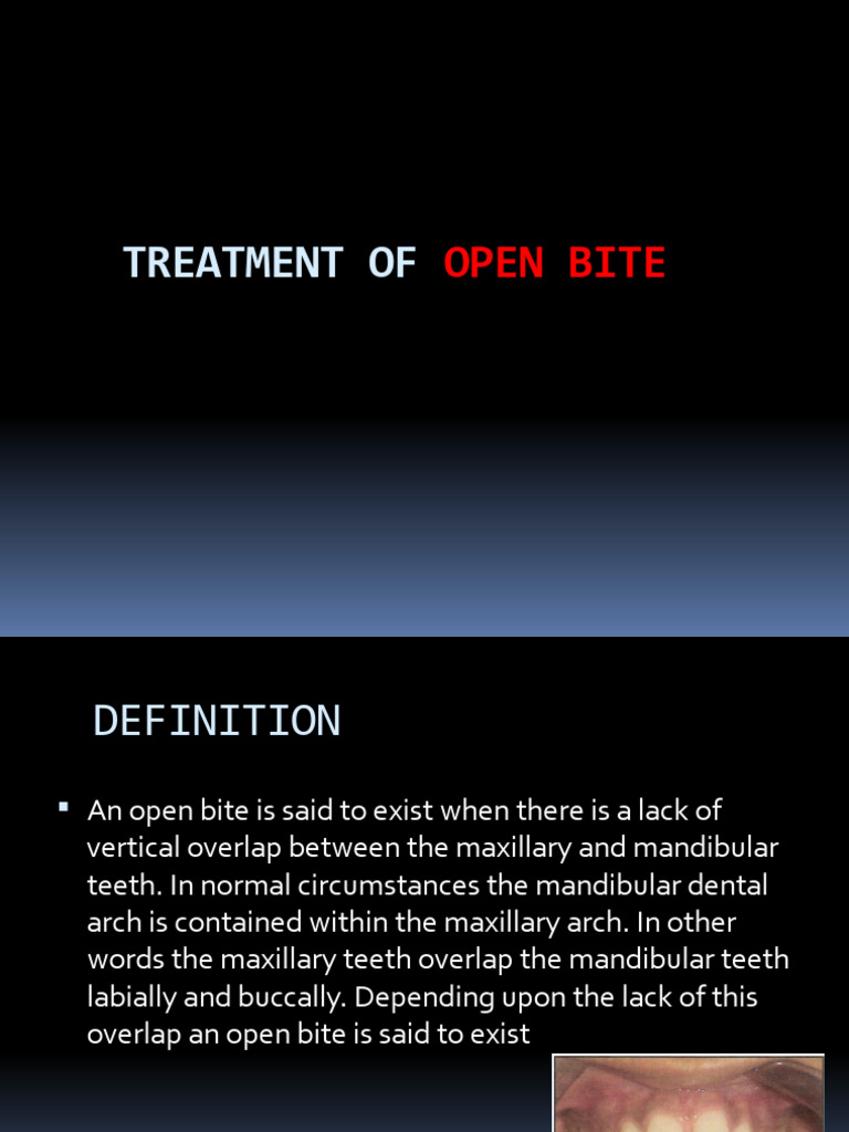 Treatment of Open Bite & Crossbite | PDF | Dentistry Branches | Mouth