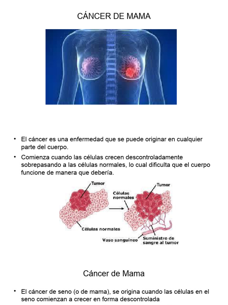 cancer de mama | PDF | Cáncer de mama | Cáncer