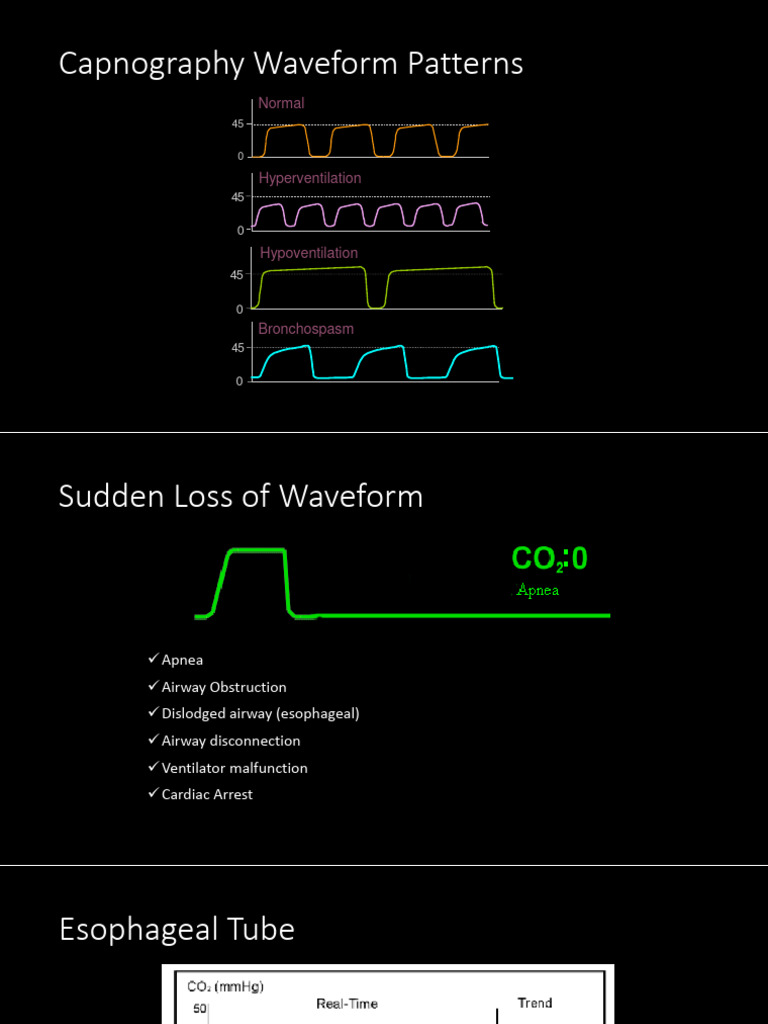 Capnography Waveform Patterns Analysis | PDF
