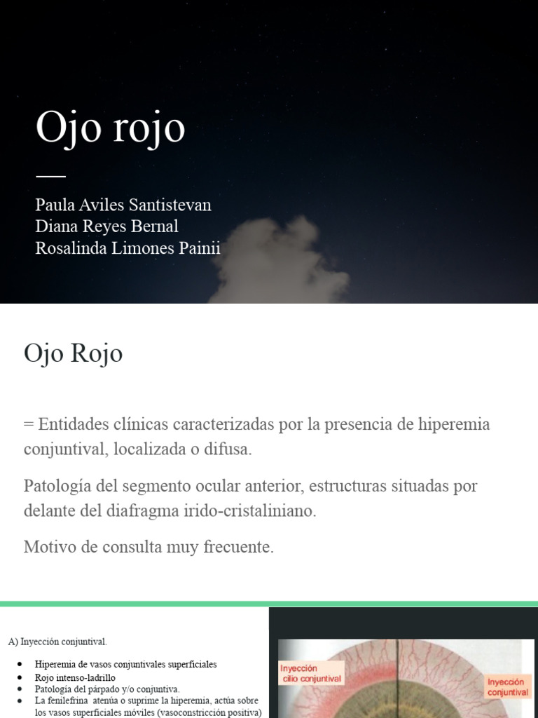ojo rojo | PDF | Ojo humano | Glaucoma