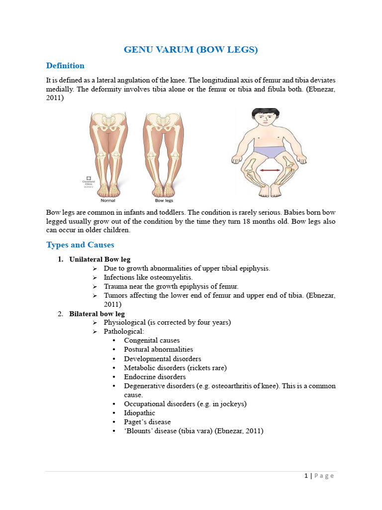 Bow Leg Assignment Pdf Knee Clinical Medicine