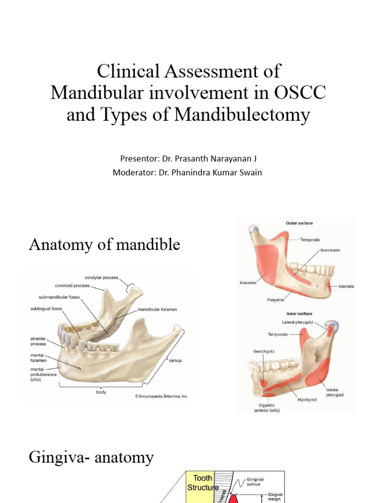 Clinical Assessment of Mandibular Involvement in OSCC and | PDF ...