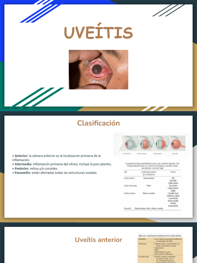 UVEITIS | PDF | Ciencias de la Salud | Medicina CLINICA
