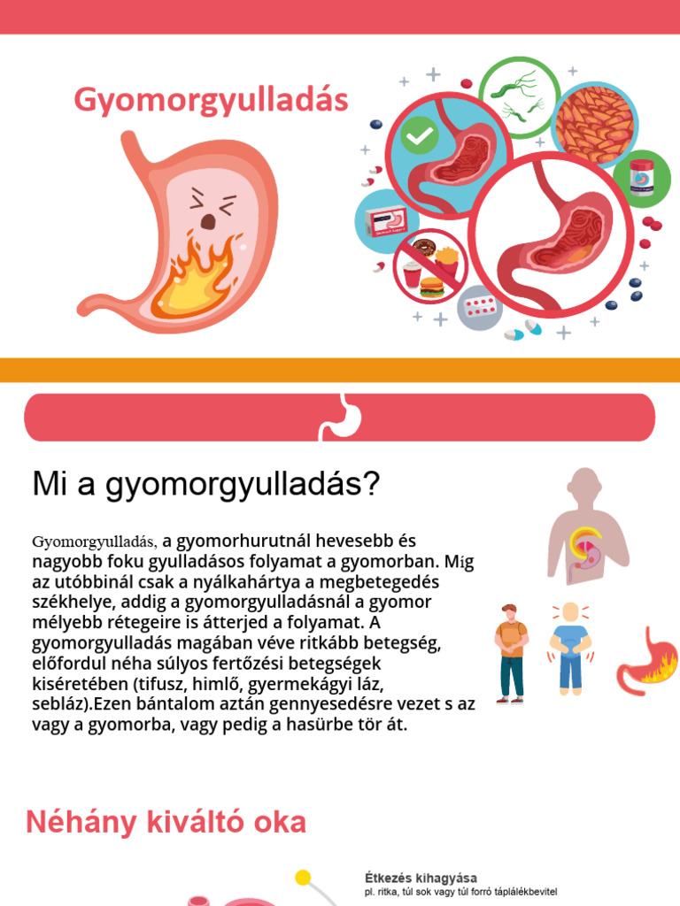 Gyomorgyulladás | PDF