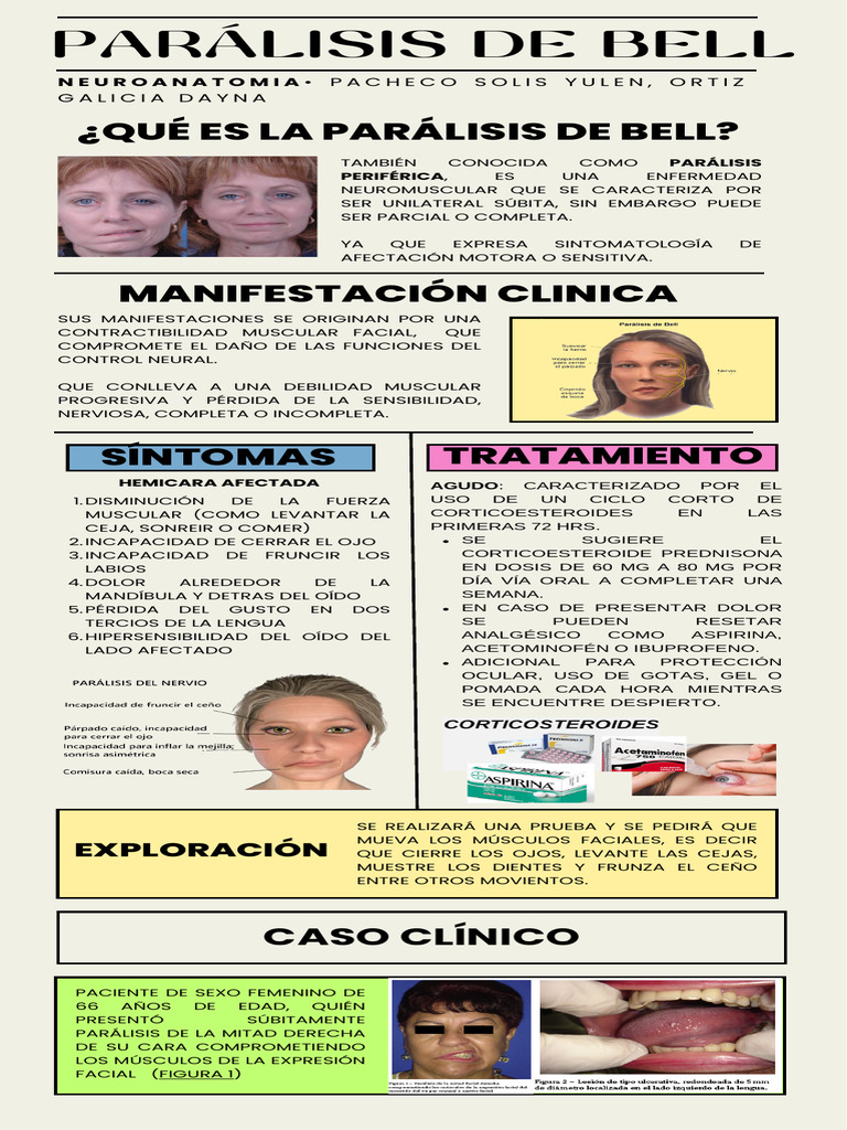 Parálisis de Bell: Síntomas y Tratamiento | PDF | Sistema nervioso ...