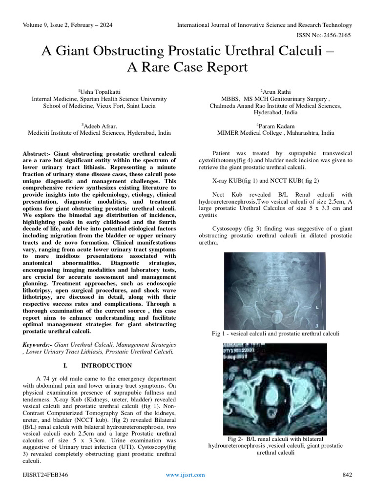A Giant Obstructing Prostatic Urethral Calculi - A Rare Case Report ...