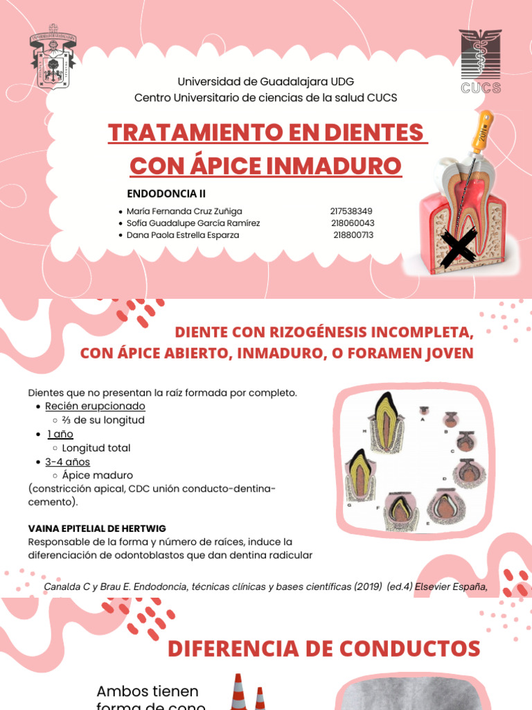 Tratamiento en Dientes Con Ápice Inmaduro | PDF | Especialidades ...