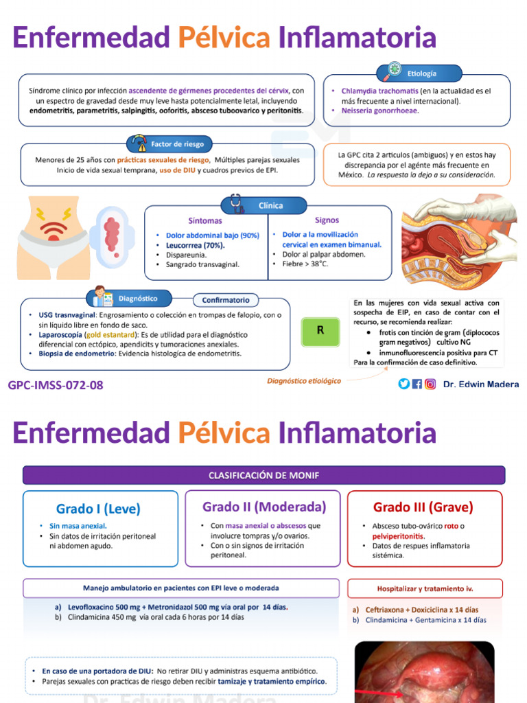 Enfermedad Pélvica Inflamatoria | PDF