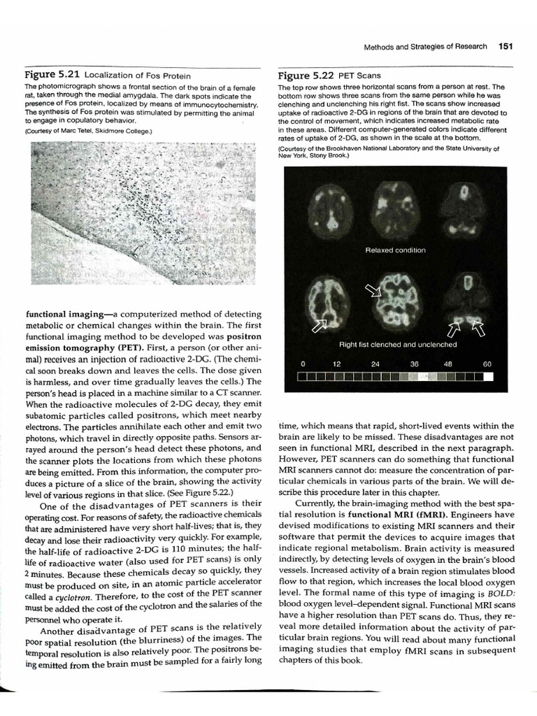 Methods To Study Brain (EEG, CT, fMRI) | PDF
