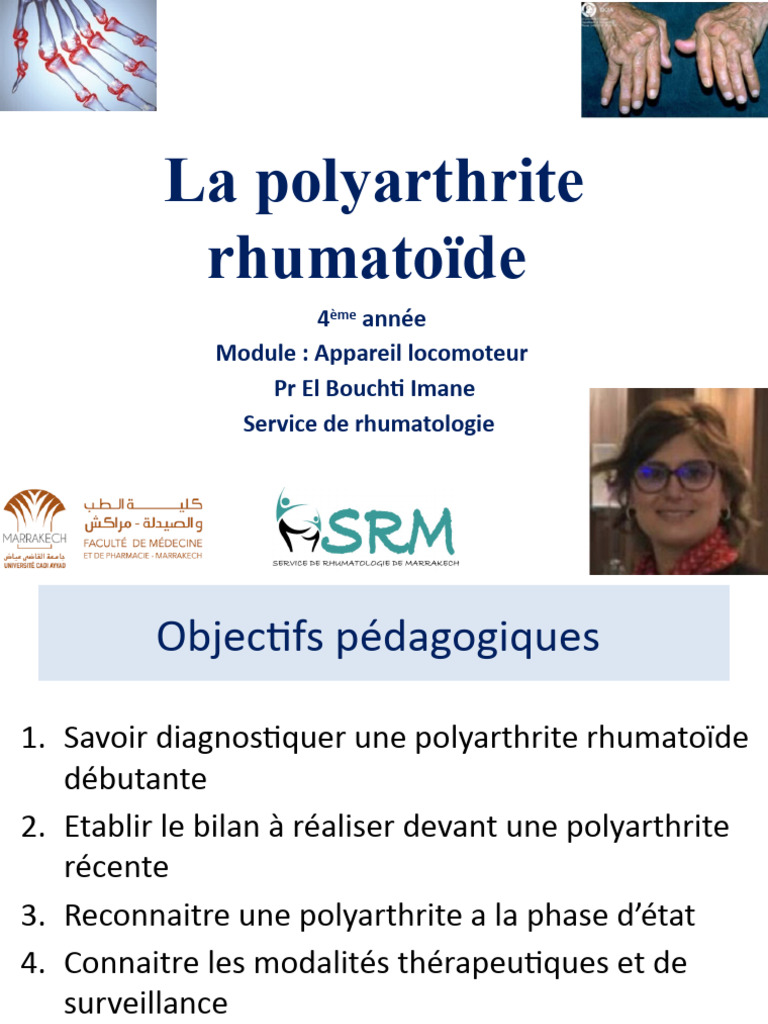 La Polyarthrite Rhumatoïde PR I.ELBOUCHTI | PDF | Polyarthrite ...