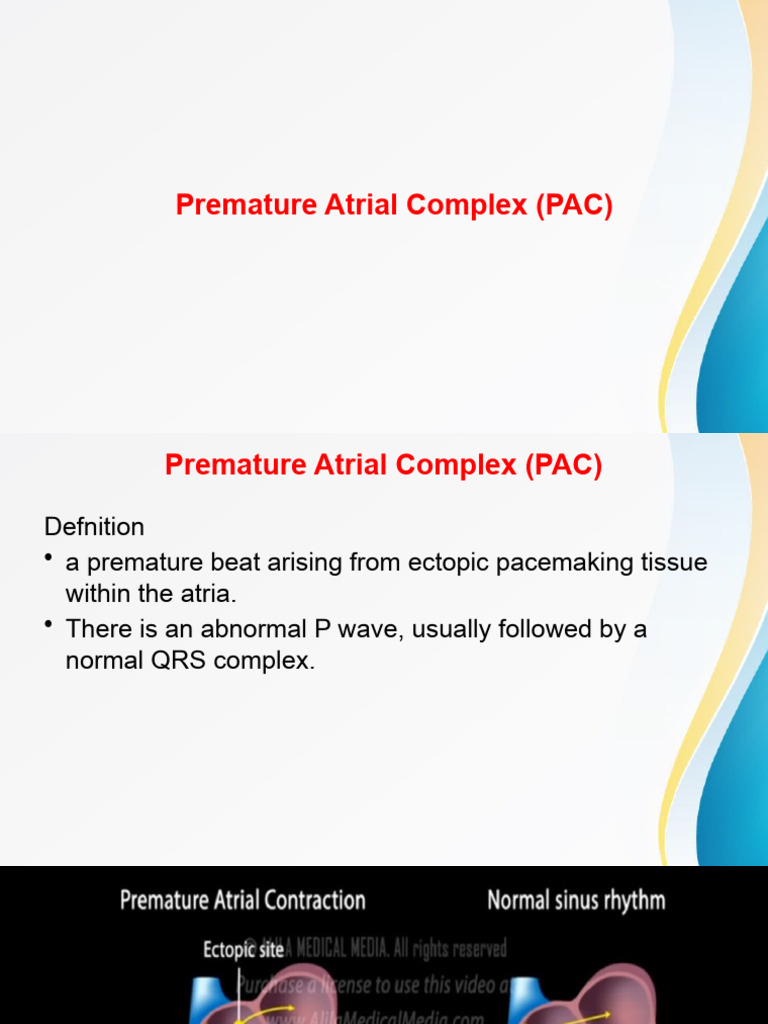 Premature - Atrial - Complex Final | PDF