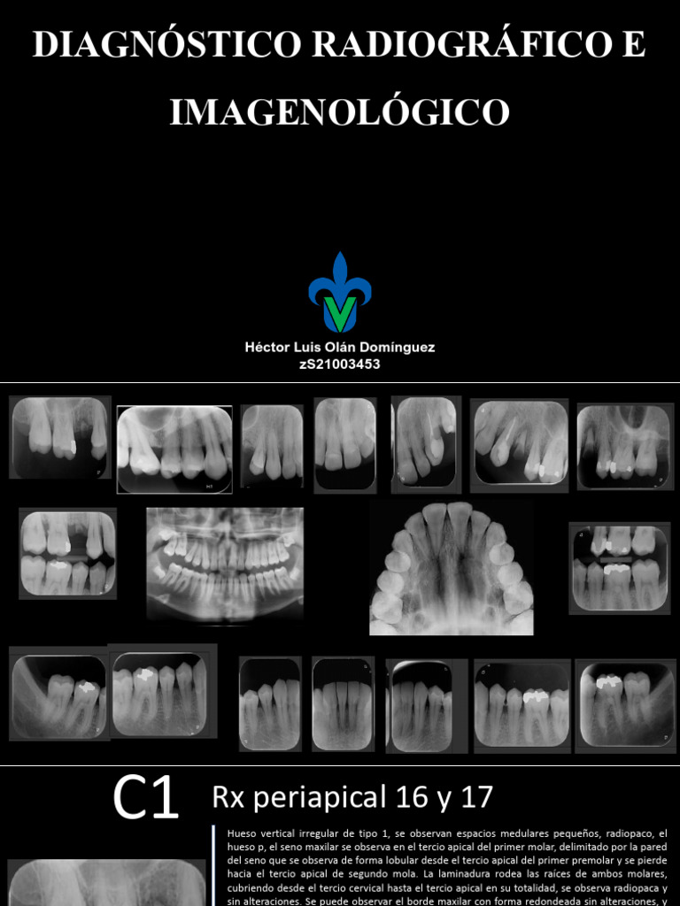 Radiografías Periapicales | PDF | Anatomia dental | Ramas de Odontología
