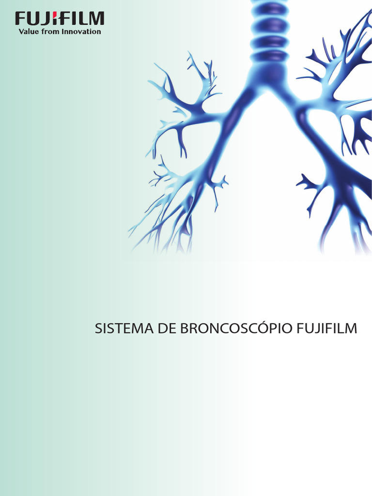 Sistema de Broncoscópio | PDF | Ultrassom médico | Ultrassom