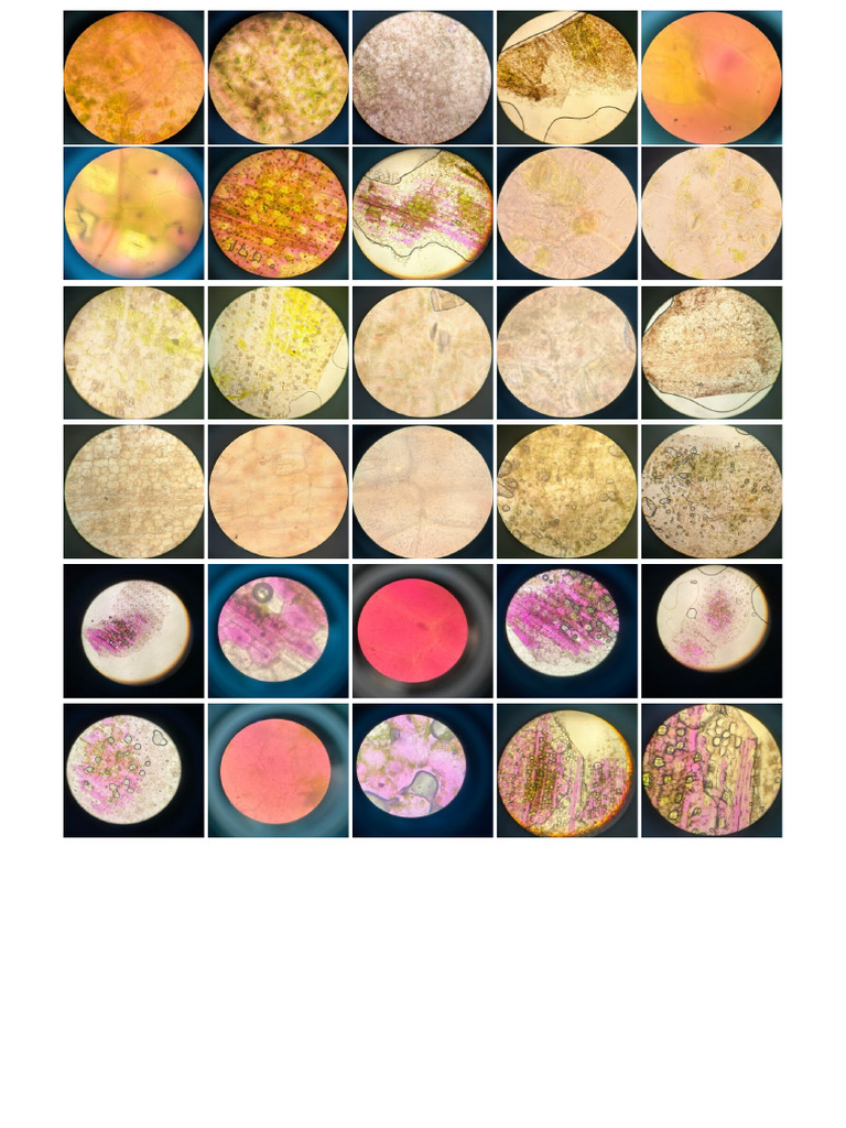 Gambar Sel Plasmolisis | PDF