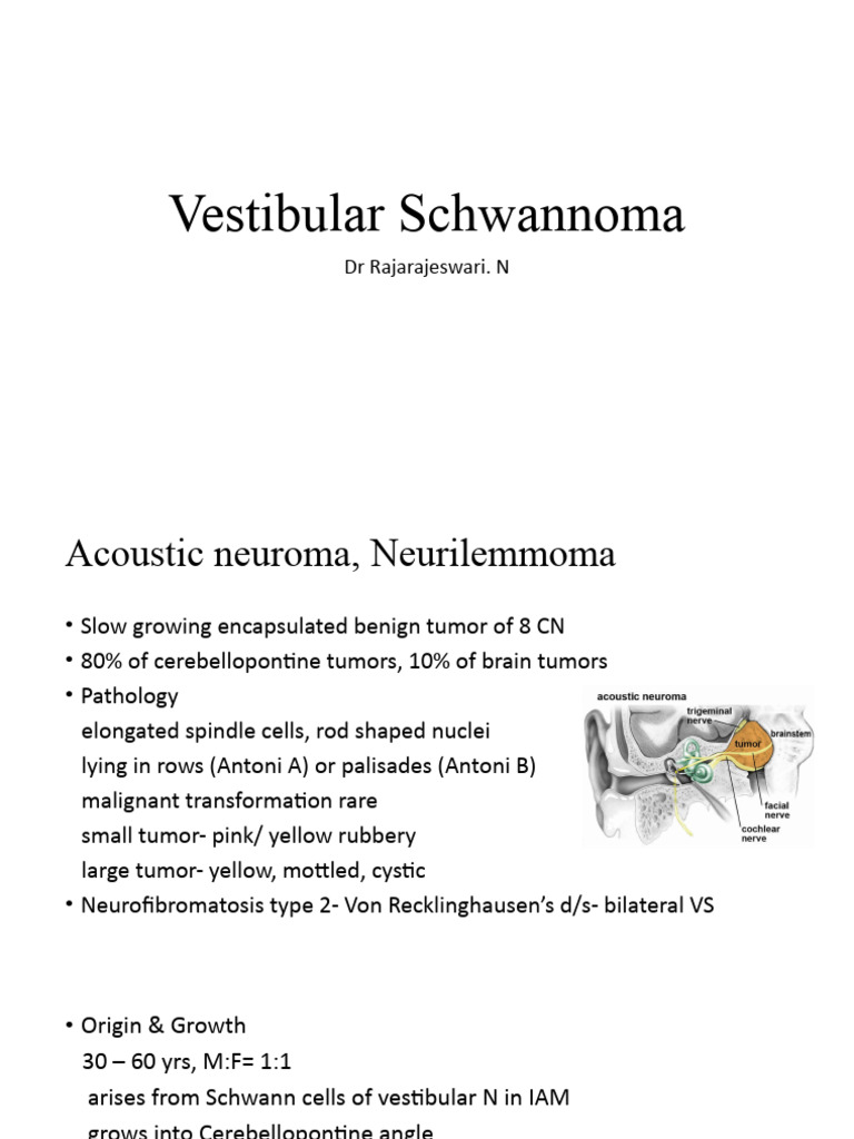 Vestibular Schwannoma Overview and Treatment | PDF