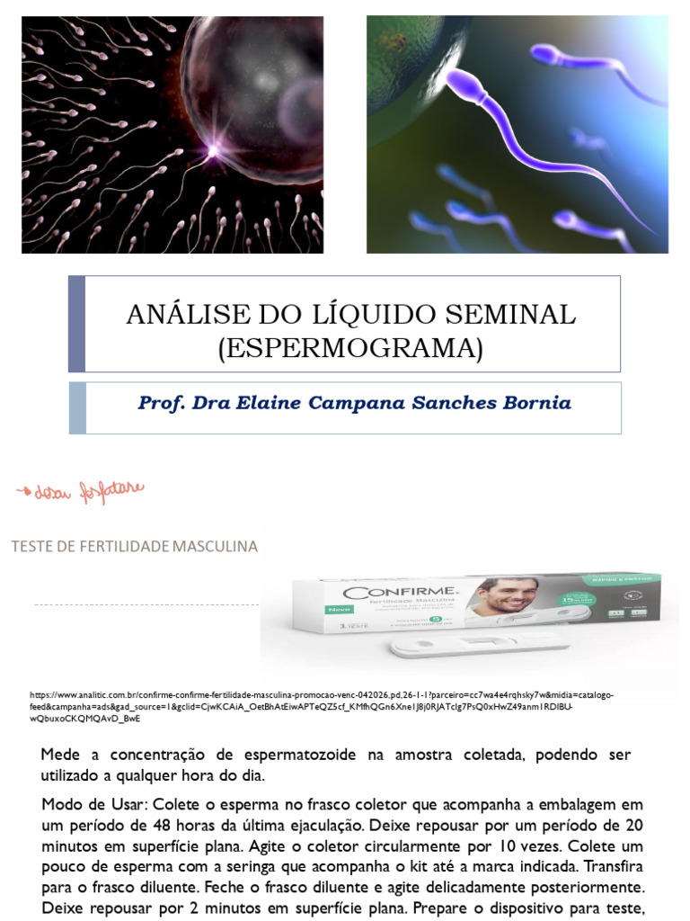 E Spermogram A | PDF | Sêmen | Próstata