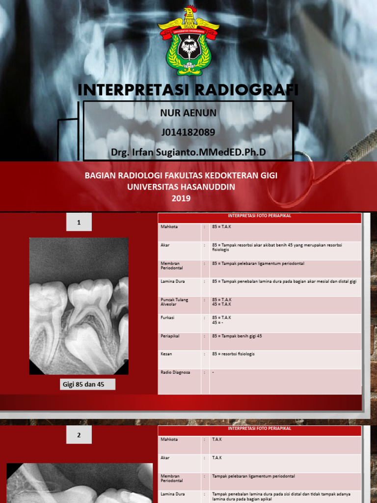 Interpretasi Radiografi Nur Aenun DRG Irfan | PDF