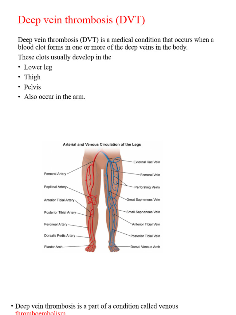 Prevention of DVT | PDF | Thrombosis | Vein