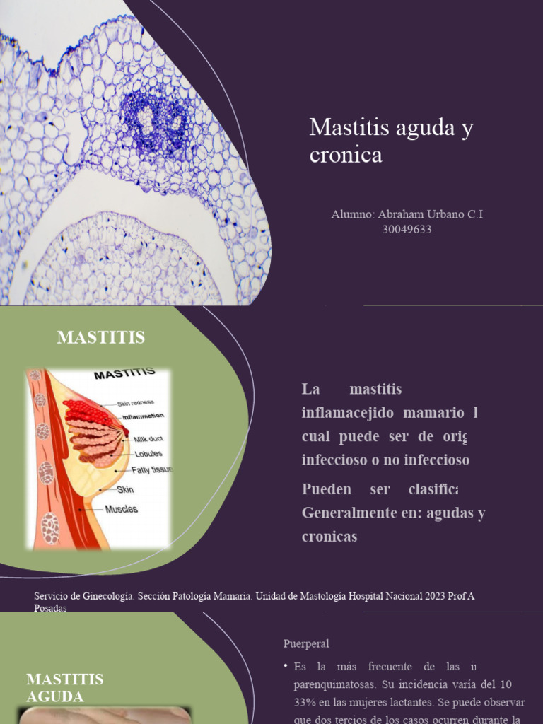 Mastitis Aguda y Crónica | PDF | Medicina | Causas de la muerte