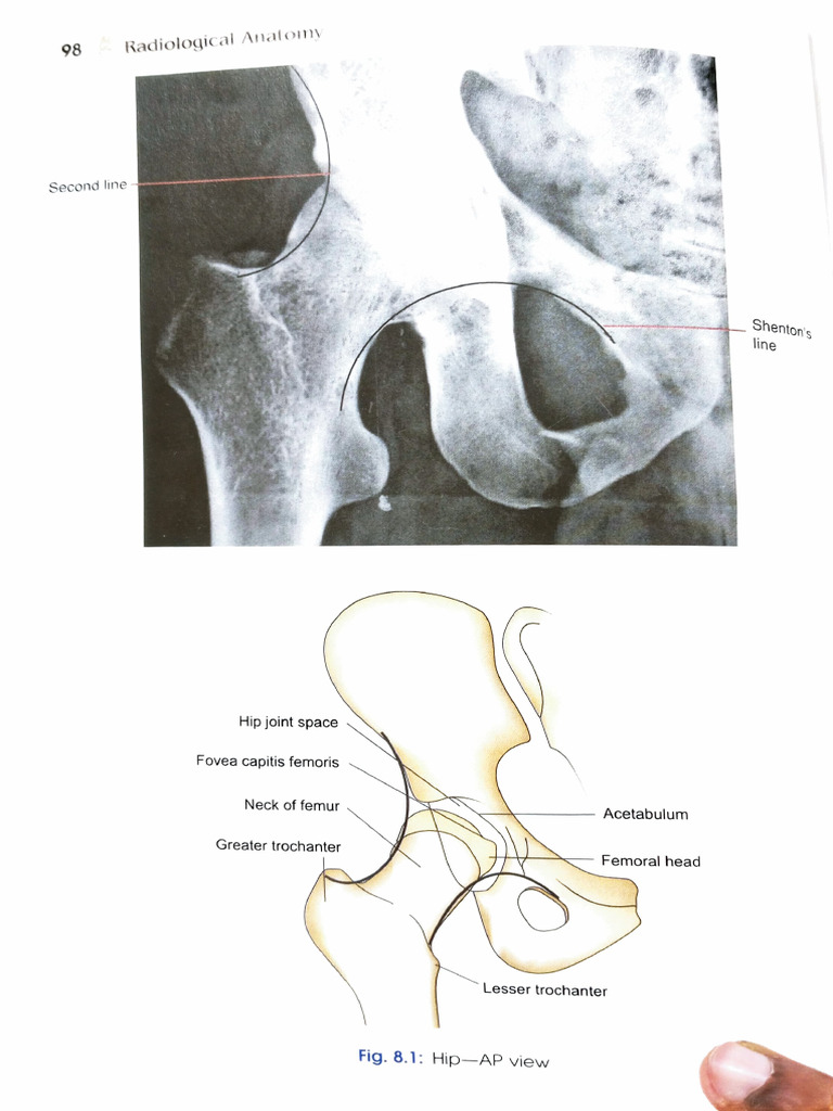 Radiology-Lower Limb | PDF