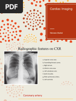 ICU One Pager External Pacemakers v11 | PDF | Artificial Cardiac ...