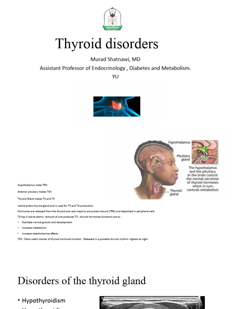 Lec#15+16 Thyroid Disorders | Download Free PDF | Hypothyroidism | Hyperthyroidism