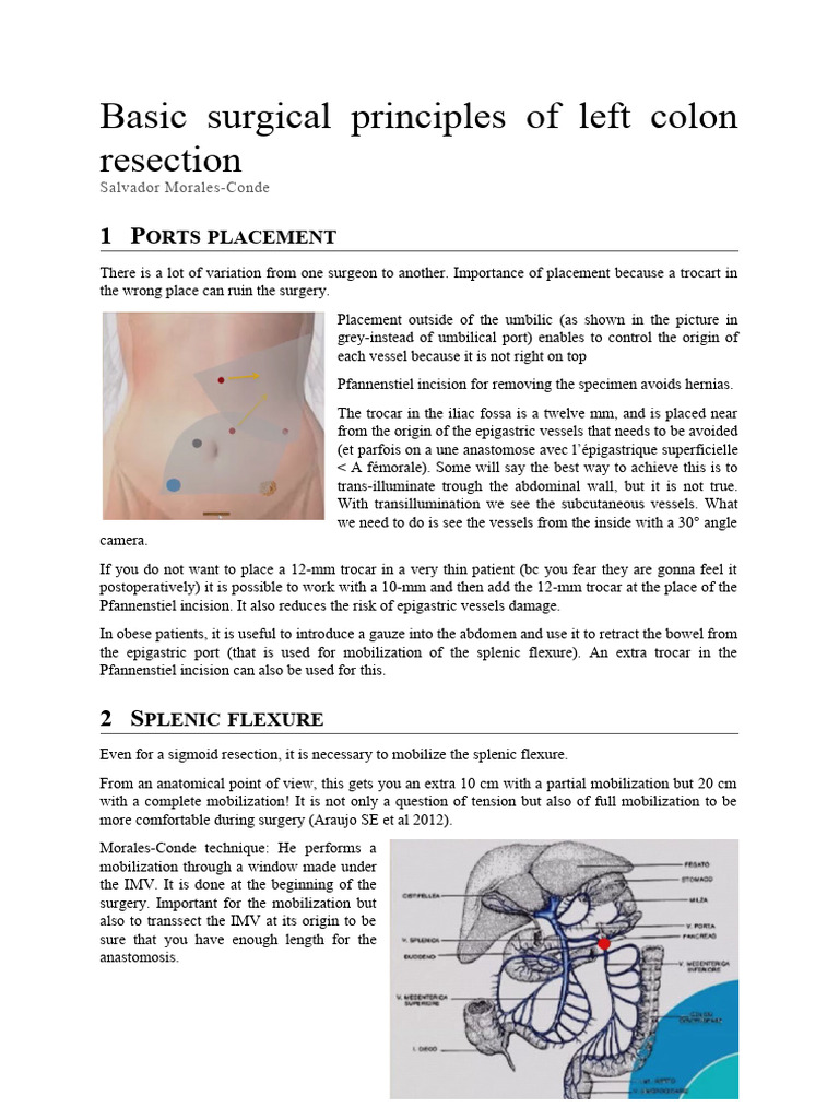 Basic Surgical Principles of Left Colon Resection | Download Free PDF ...