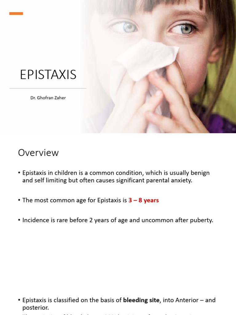 Epistaxis | PDF | Human Nose | Bleeding