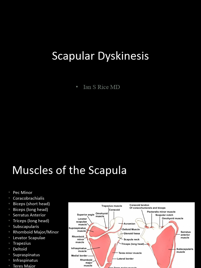 Scapular Dyskinesis Disabled Throwing Shoulder | PDF | Anatomical Terms ...