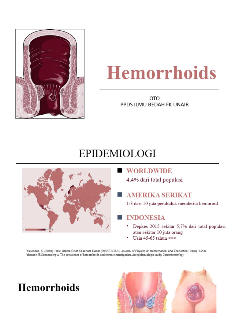 Hemoroid Oto | PDF | Hemorrhoid | Digestive Diseases