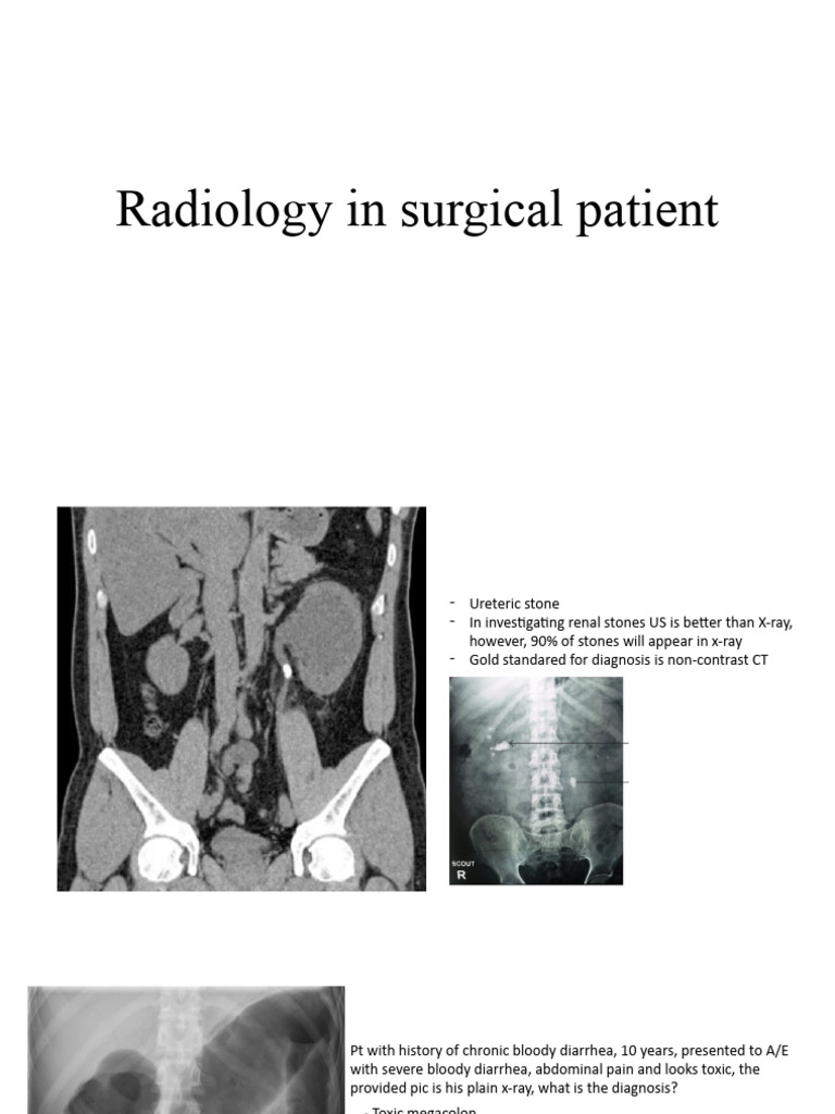 Dr. Rami Radilology Lec | PDF | Gallbladder | Clinical Medicine