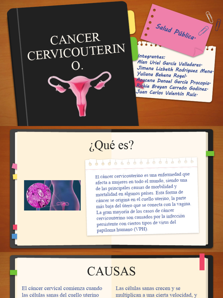 Cancer Cervicouterino SP | PDF | Cáncer de cuello uterino | Cáncer