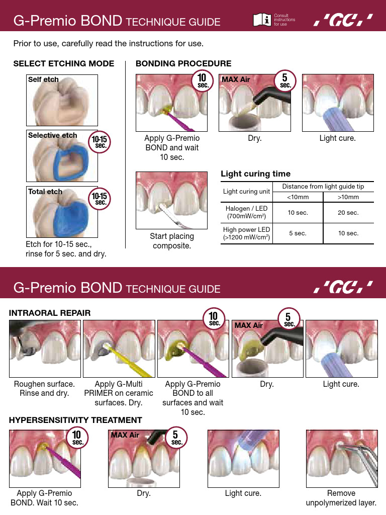 MAN G-Premio BOND Technique Guide en | PDF