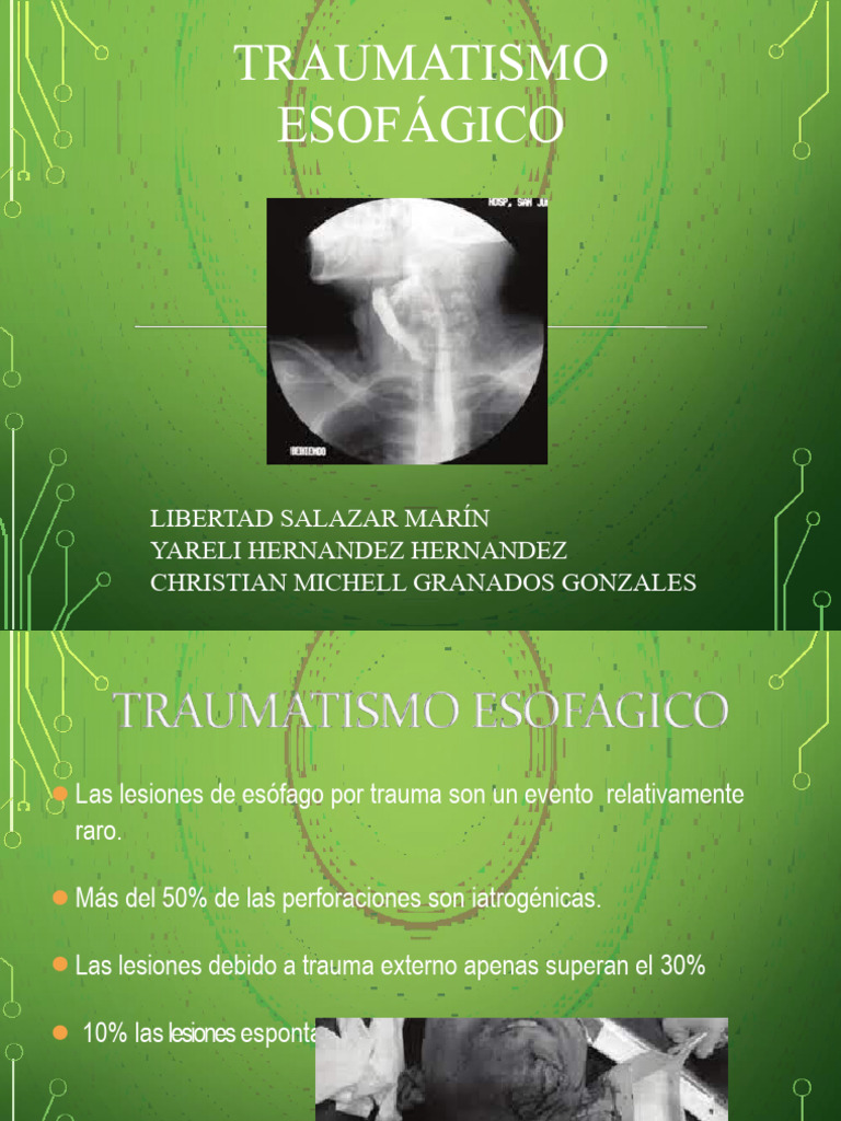 Trauma Esofagico | Descargar gratis PDF | Lesión | Especialidades Medicas