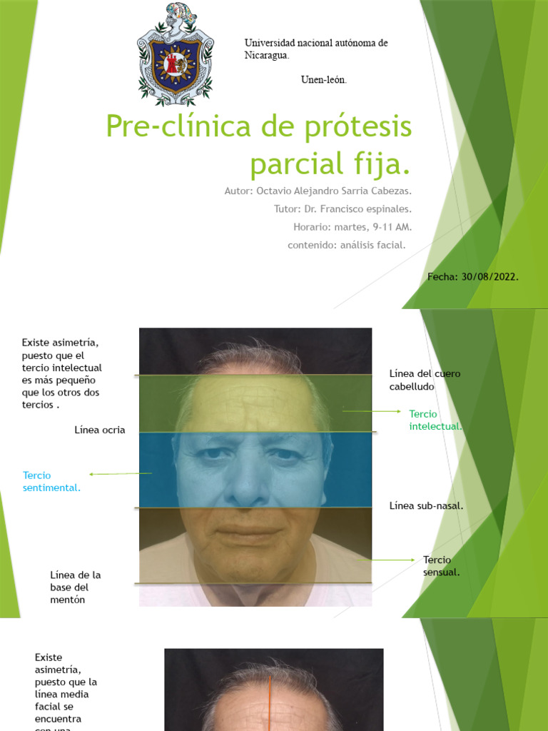 Analisis Facial Pdf Pdf