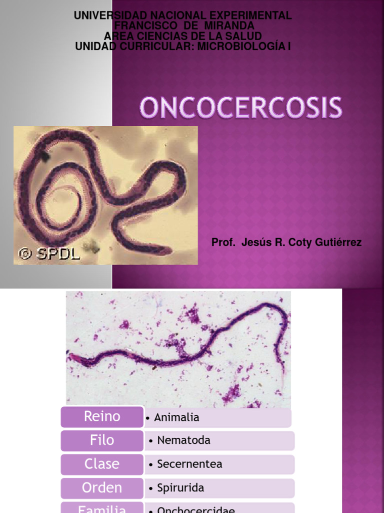 Oncocercosis | PDF | Inmunología | Epidemiología