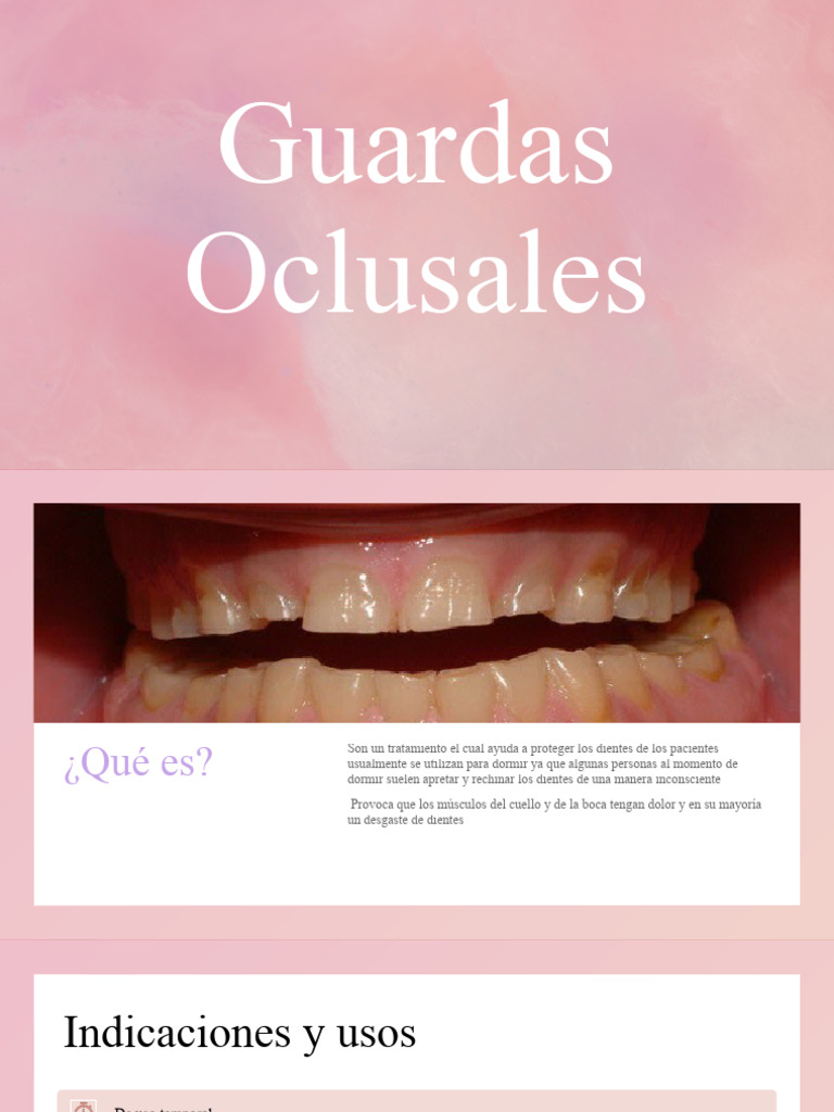 Guardas Oclusales | PDF