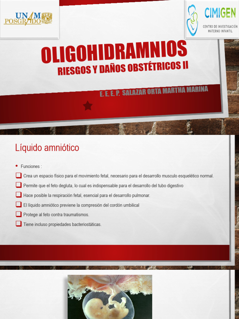 Oligohidramnios: Riesgos y Complicaciones | PDF | Feto | El embarazo