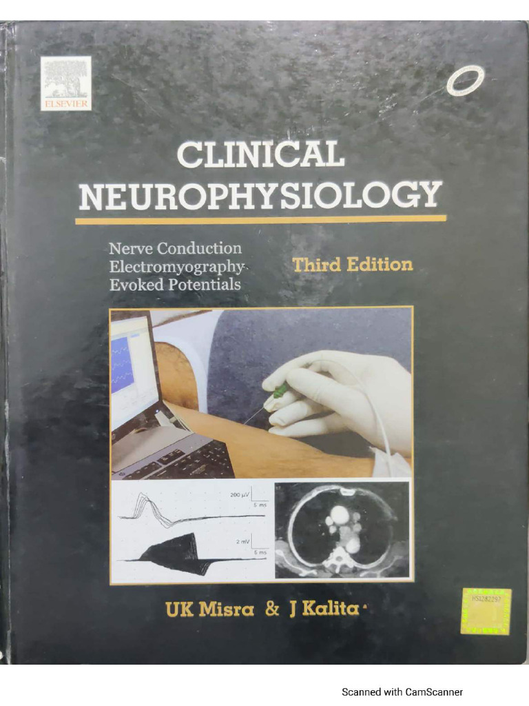 Clinical Neurophysiology Nerve Conduction, Electromyography, Evoked | PDF