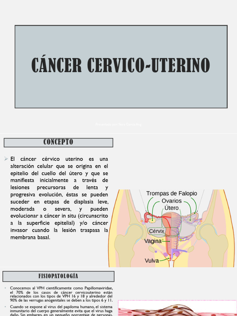 Cáncer Cervicouterino: Causas y Diagnóstico | PDF | Cáncer de cuello ...