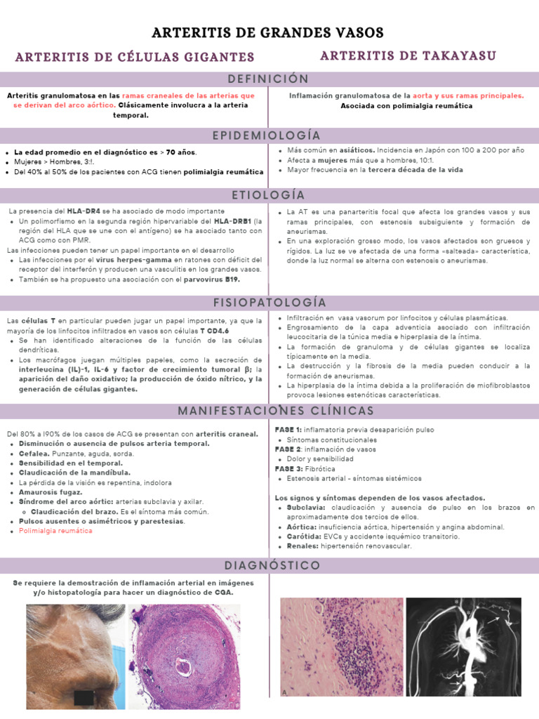 Vasculitis de Grandes Vasos | PDF | Inflamación | Isquemia