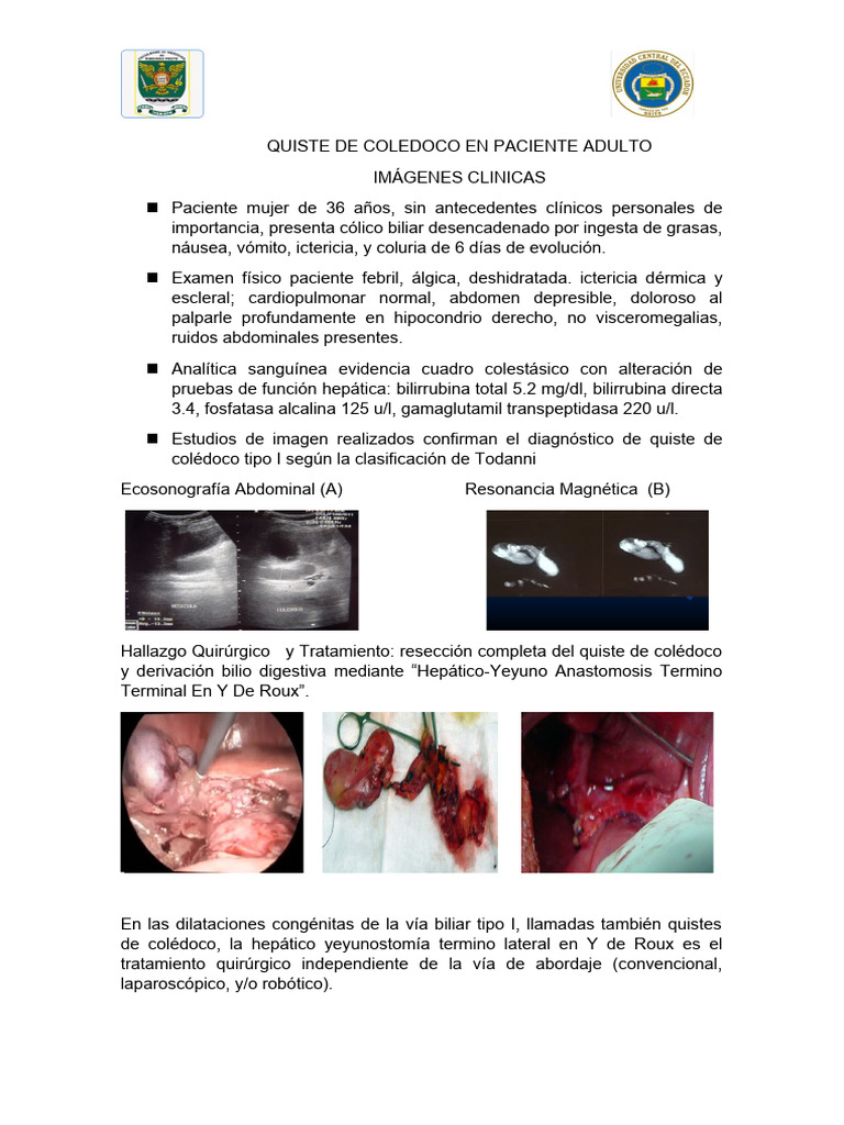 Quiste de Coledoco en Paciente Adulto | PDF