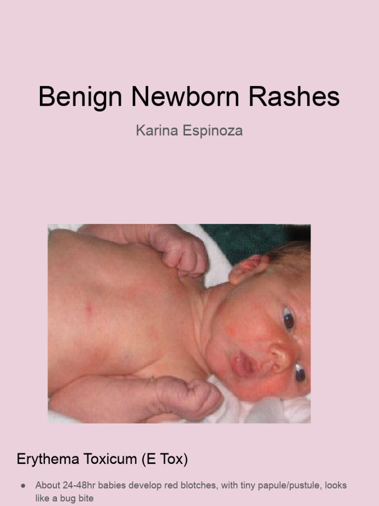 Newborn Rash | PDF | Clinical Medicine | Diseases And Disorders