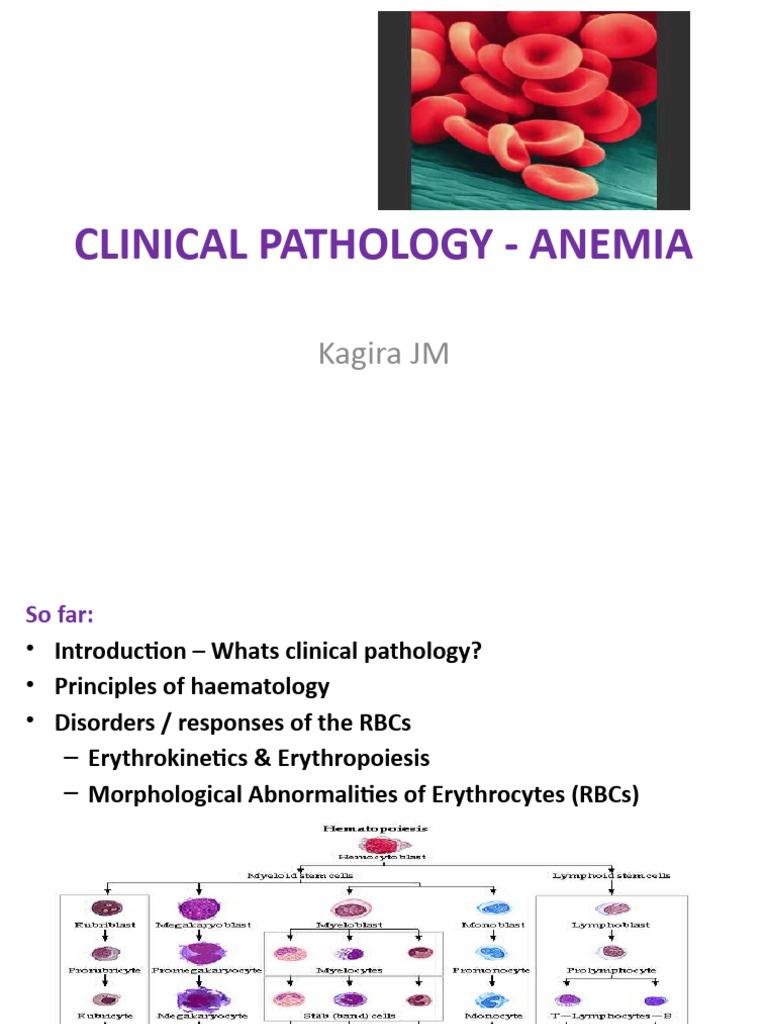 Lecture 2 - Clinical Pathology - Anemia | Download Free PDF | Anemia ...