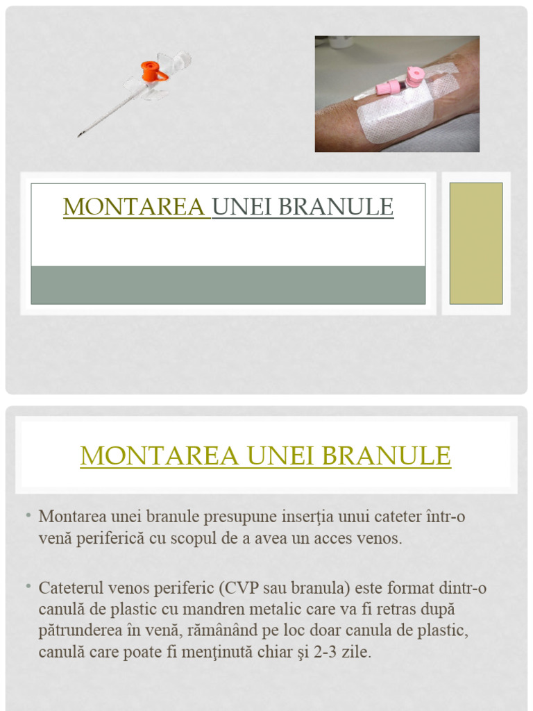 Montarea Unei Branule | PDF