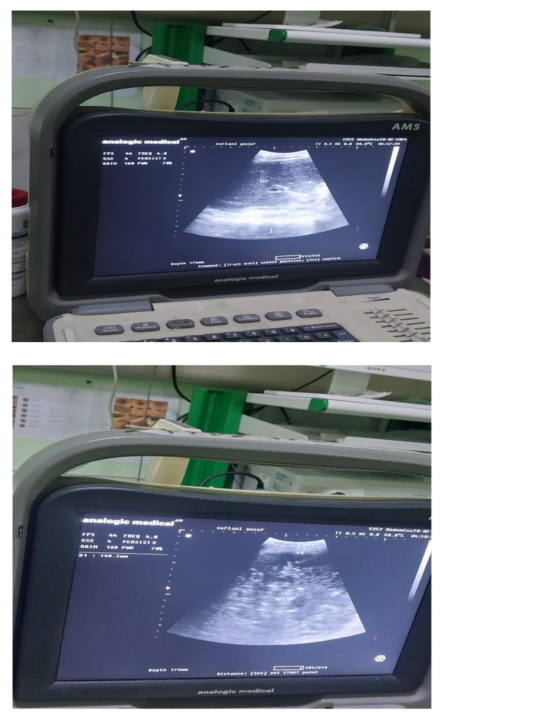 USG Abdomen | PDF