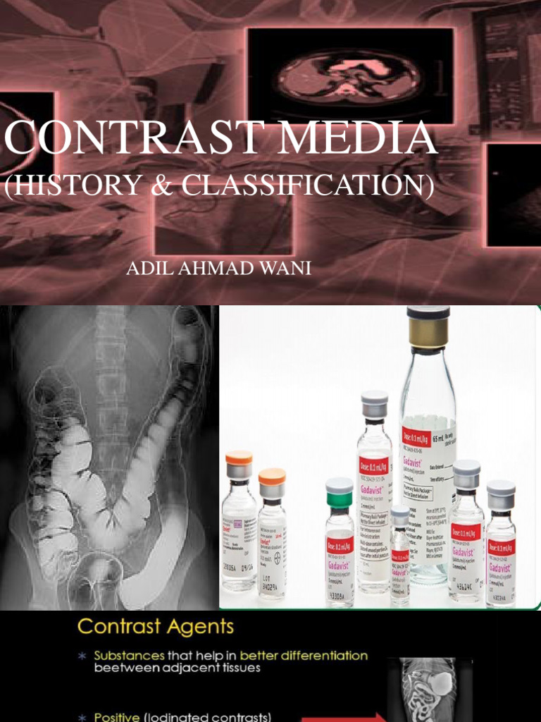 CONTRAST MEDIA by Adil | PDF | Allergy | Medical Imaging